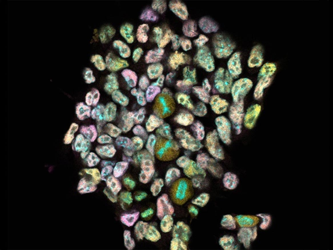 Polo Lab: Epigenetics & Reprogramming | Adelaide Centre for Epigenetics ...